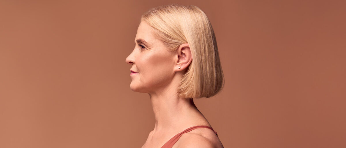 Neck Fat & Laxity - Dermatology, Laser & Vein Specialists of the Carolinas